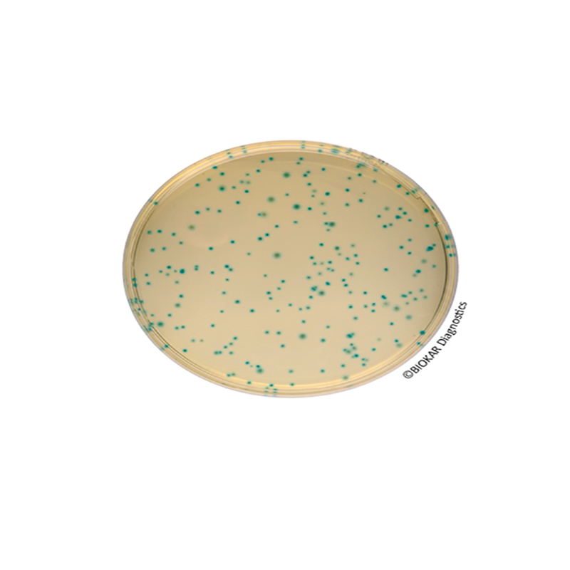 Symphony Agar for Yeast & Mold | Innovation Diagnostics